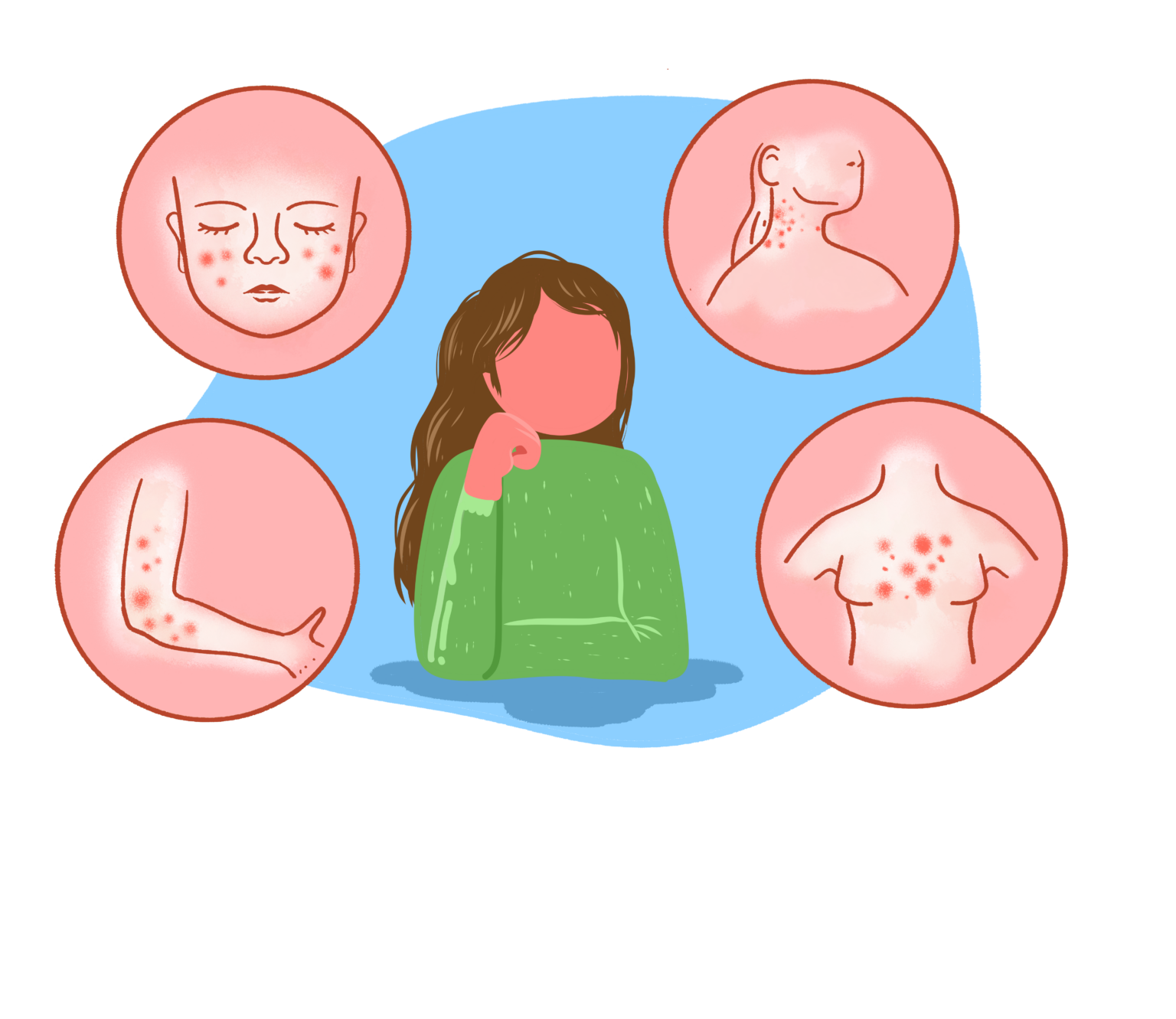 Itchy Skin Menopause - Online Menopause Centre